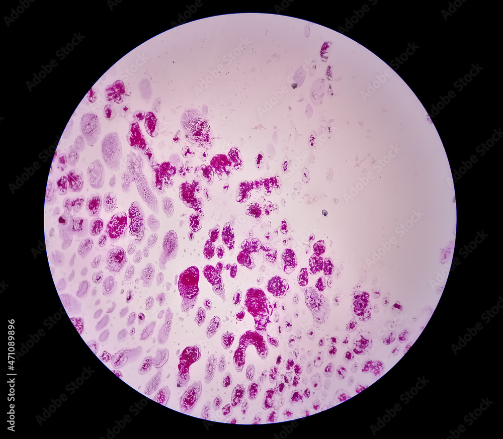 Gram staining, also known as Gram's method, is a method of ...