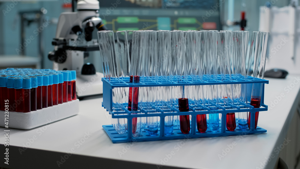Close up of laboratory test tubes with blood on desk at workplace ...