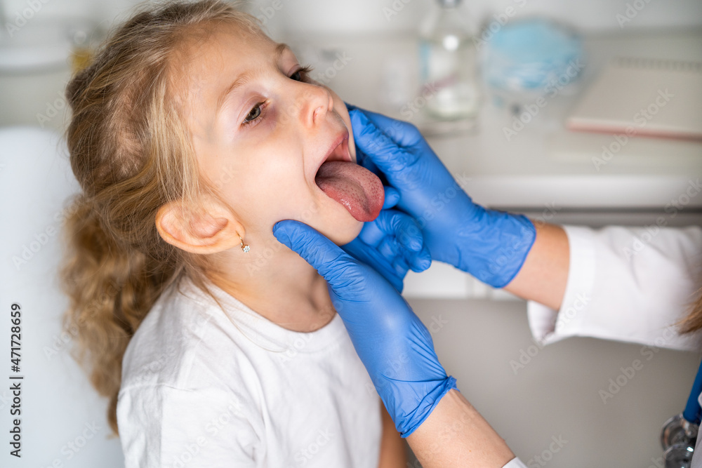 little girl at the reception at the doctor ENT, examination of the oral ...