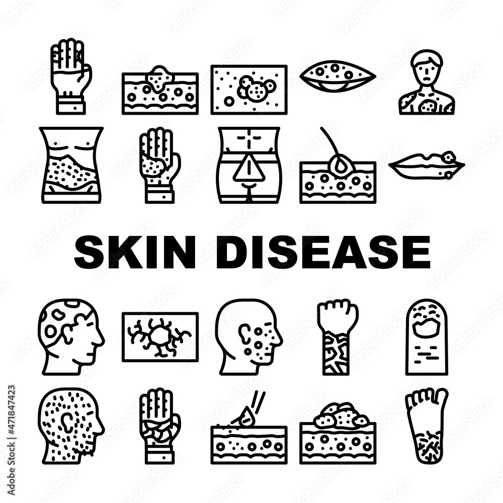 Skin Disease Human Health Problem Icons Set Vector ...