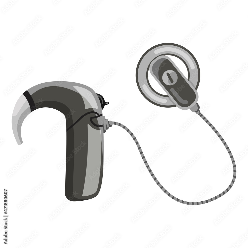 Cochlear Implant Vector illustration. Hearing therapy concept. Stock ...