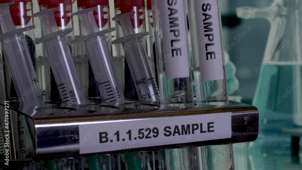Close up tilt pan of a laboratory rack being filled with research ...