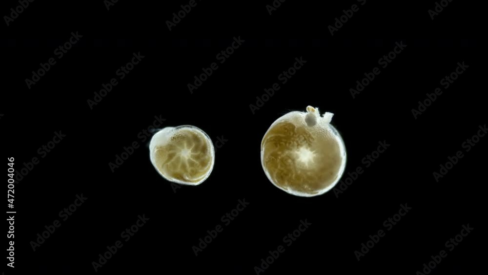 Foraminifera under a microscope, class Rotaliata, possibly order ...