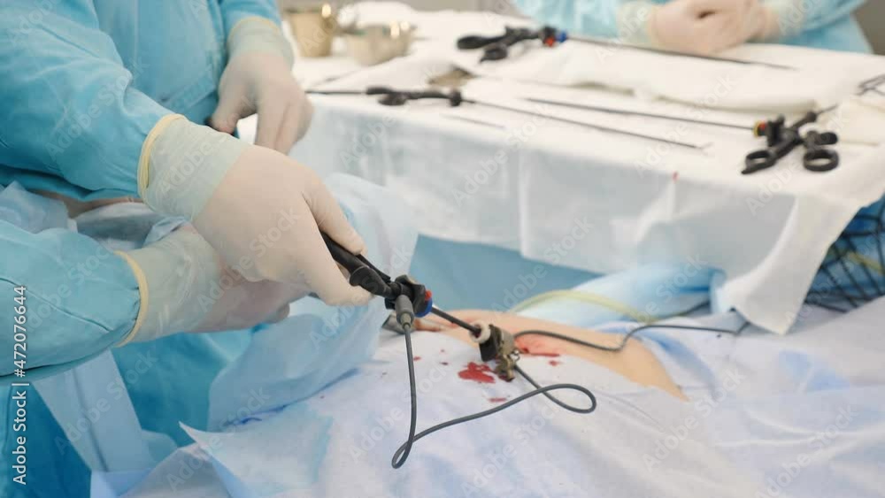 Laparoscopic surgery in hospital. Modern medical equipment in operating room. Surgical ...