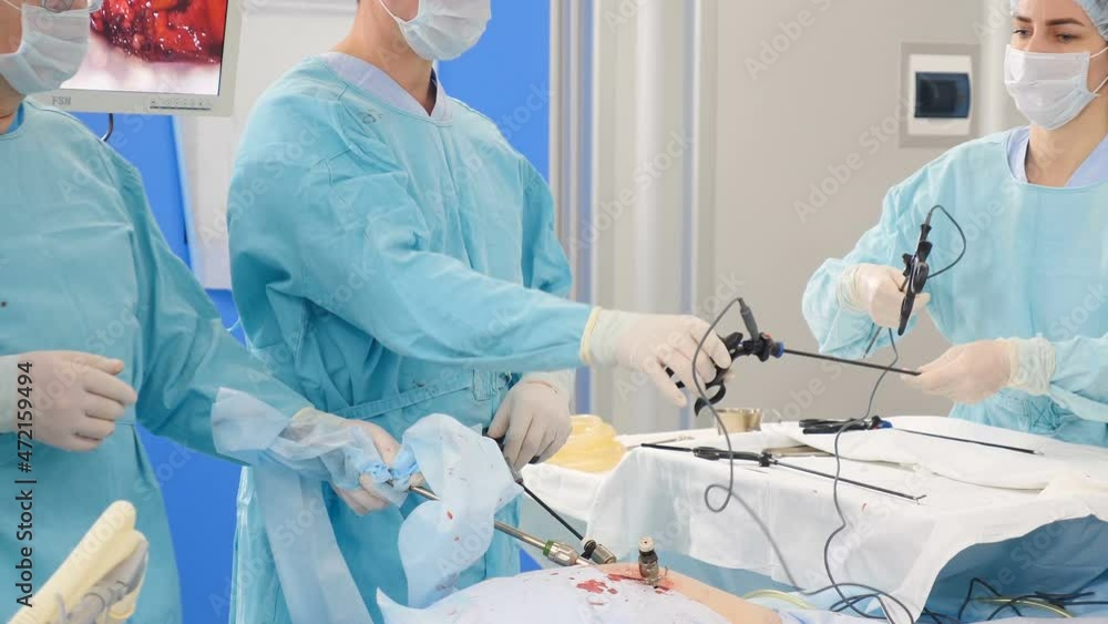 Laparoscopic surgery in hospital. Modern medical equipment in operating ...