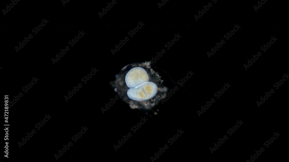 Two ciliates Ciliophora under the microscope, Alveolata. Found inside ...