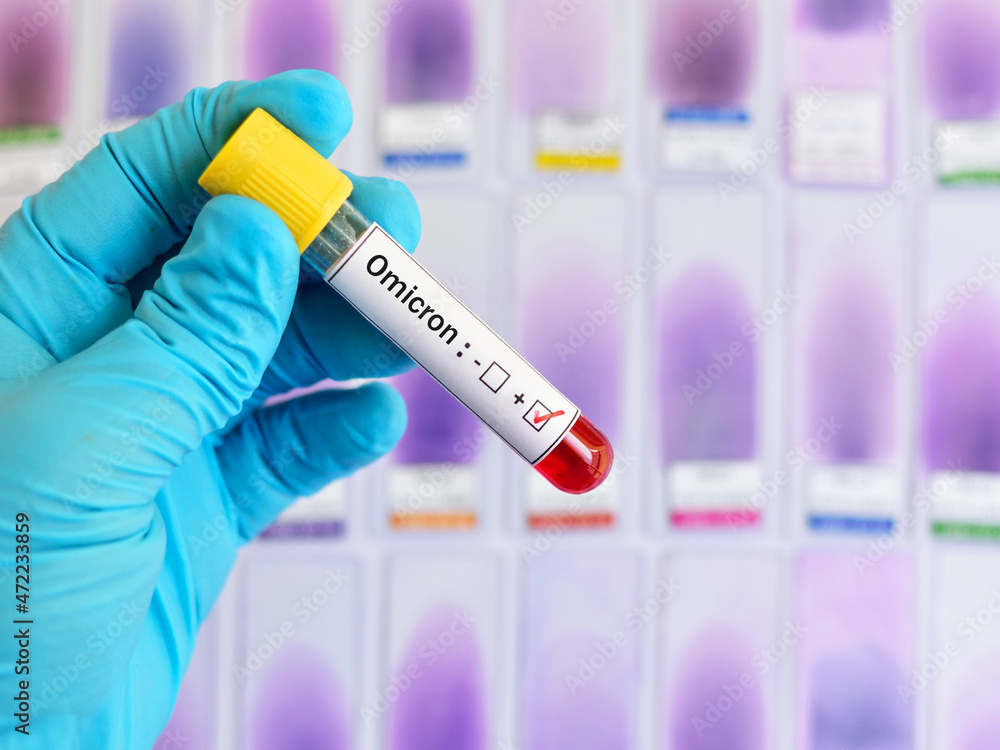 Omicron positive, blood sample tube positive with Omicron or B.1.1.529 ...