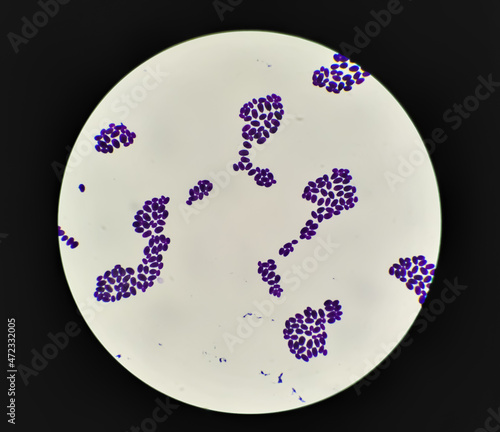 Micrococcus Luteus Gram Stain