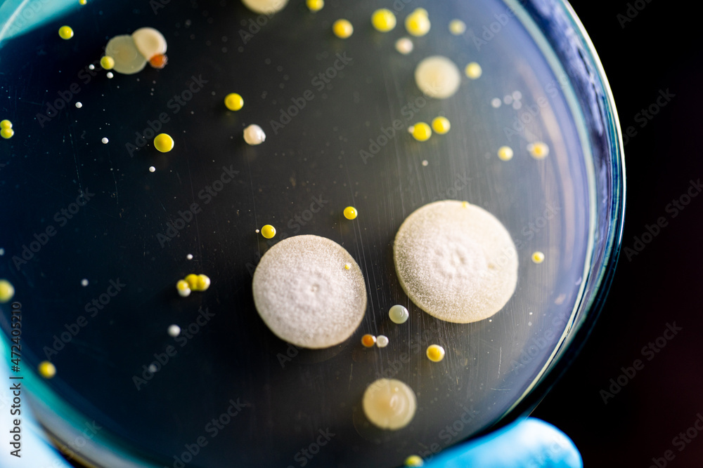 Backgrounds of Characteristics and Different shaped Colony of Bacteria ...