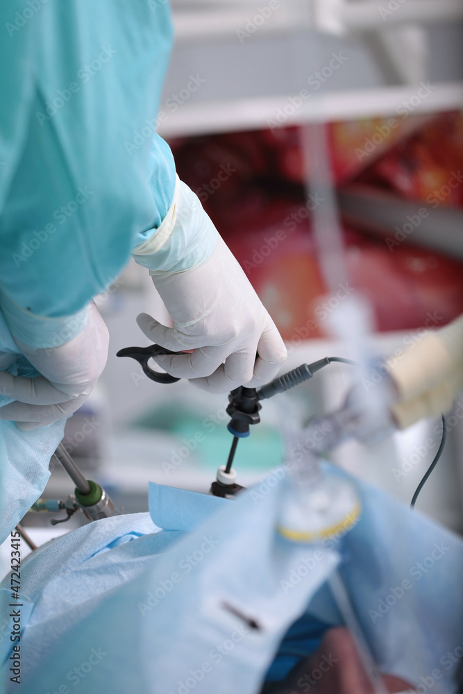 Inguinal hernia. Laparoscopic surgery to remove an inguinal hernia ...