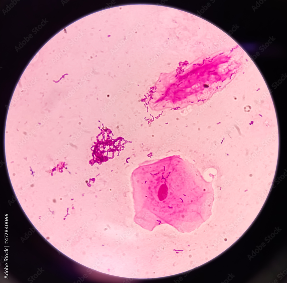 Gram Stain Microscopic Slide Plenty Epithelial Cells Few Pus Cells