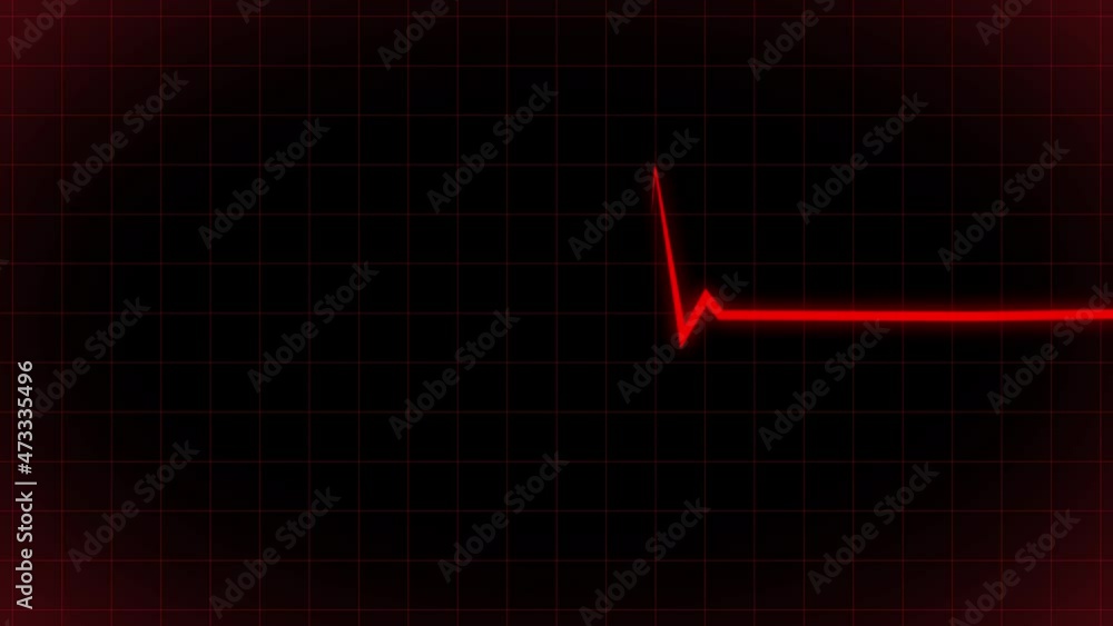 Heart rate pulse animation on graph . Seamlessly loop animation. vídeo ...