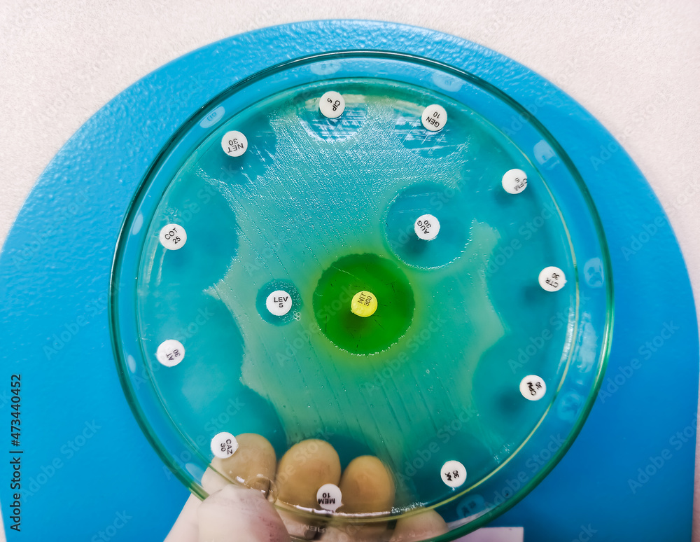 Antimicrobial susceptibility testing in culture plate. Drug sensitivity ...