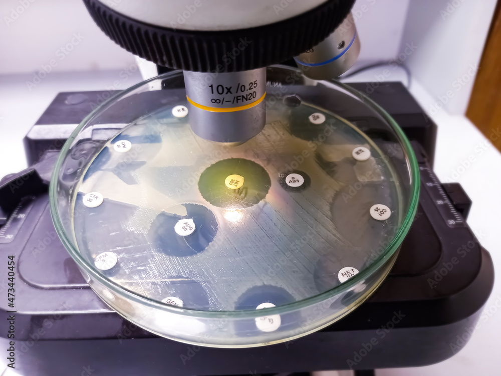Antimicrobial susceptibility testing in culture plate. Drug sensitivity ...