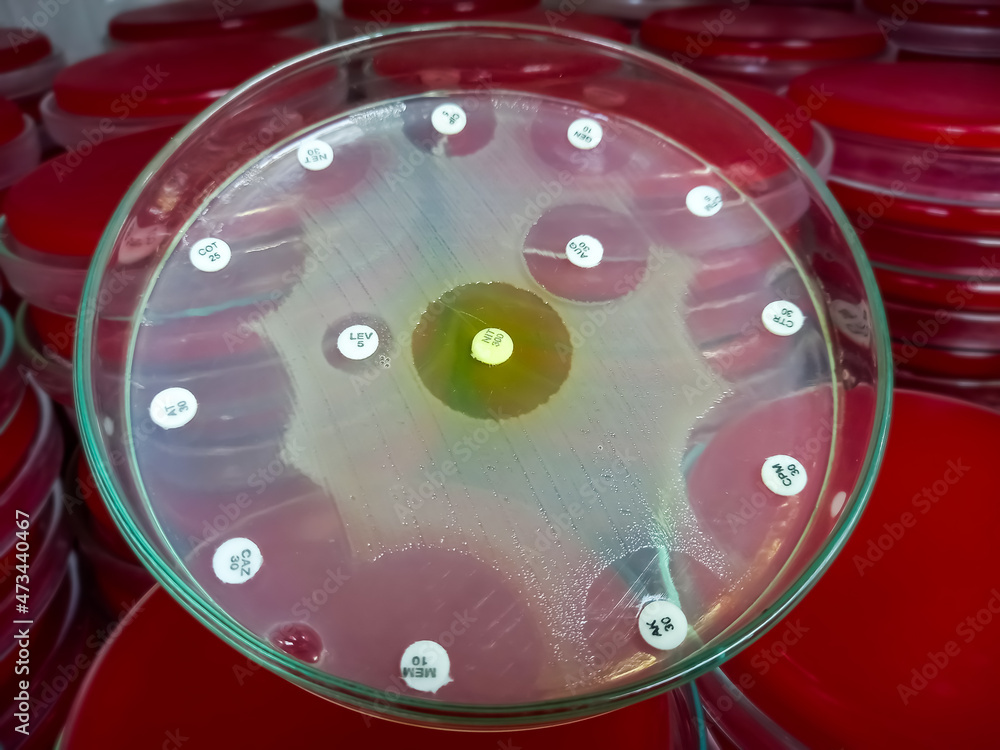 Antimicrobial susceptibility testing in culture plate. Drug sensitivity ...
