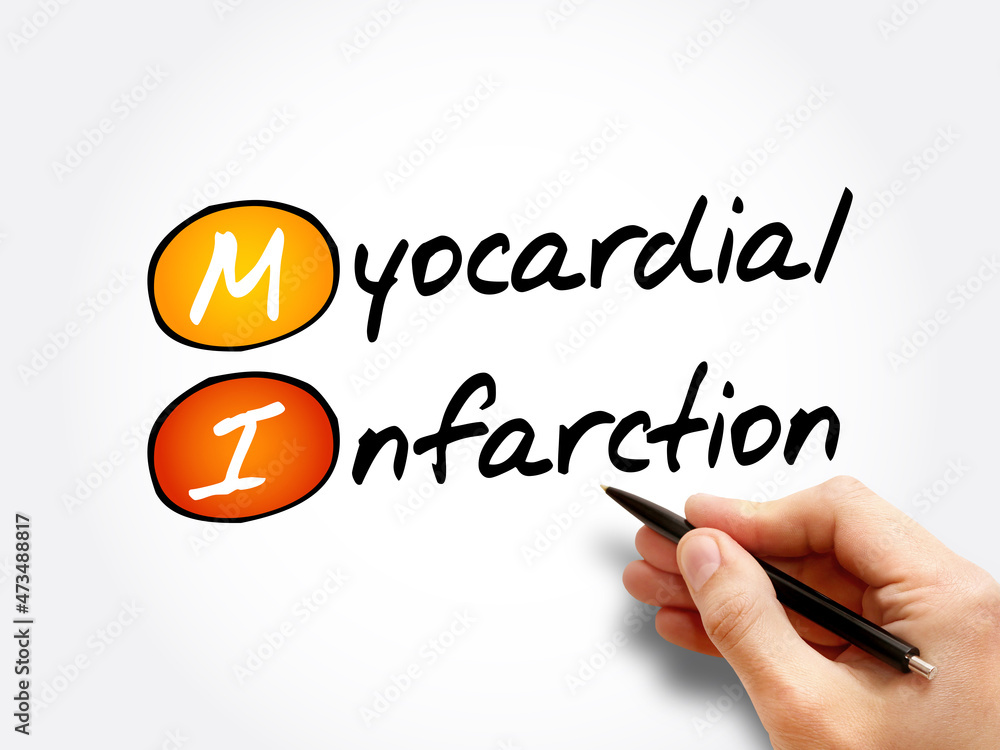 MI - Myocardial Infarction acronym, health concept background Stock ...