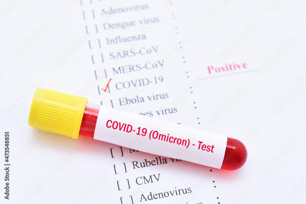Blood sample tube for Omicron or B.1.1.529 variant of COVID-19 ...
