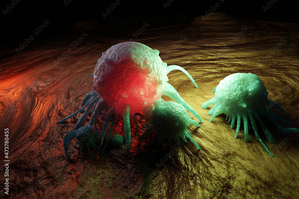 Three dimensional render of cancer cells inside human body Stock Photo ...