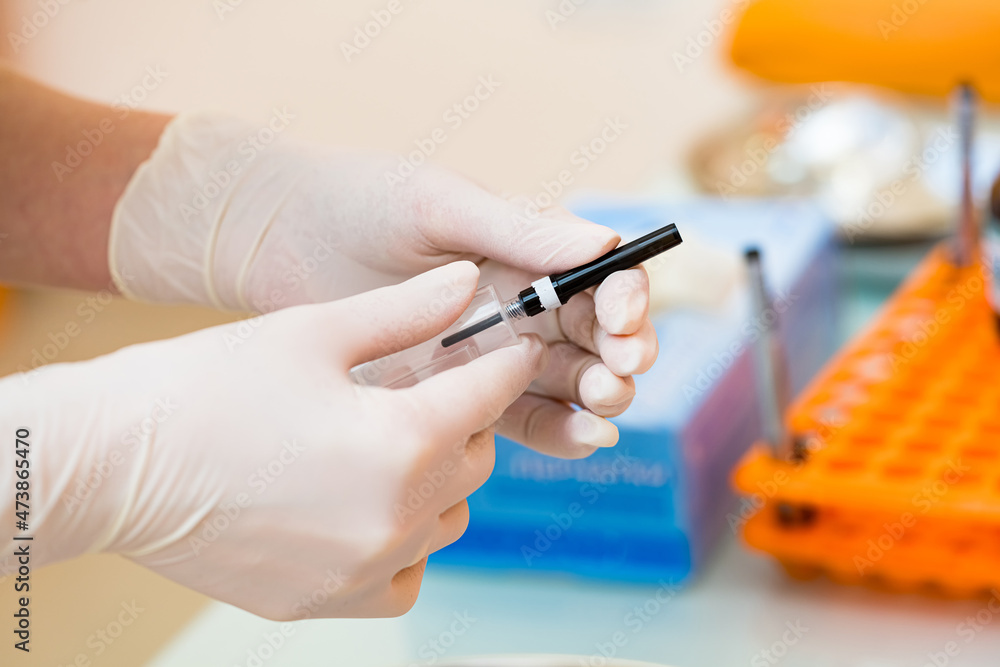 Rack of blood tubes test for analysis in the laboratory of hematology ...