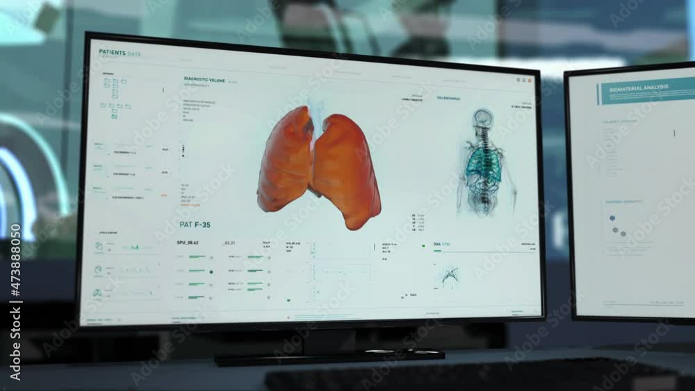 CT scan medical software. Patient Data is Processed by the CT scan ...