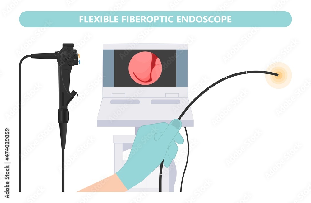 Nasal Endoscopy. Throat back voice box larynx vocal cord pain airway ...