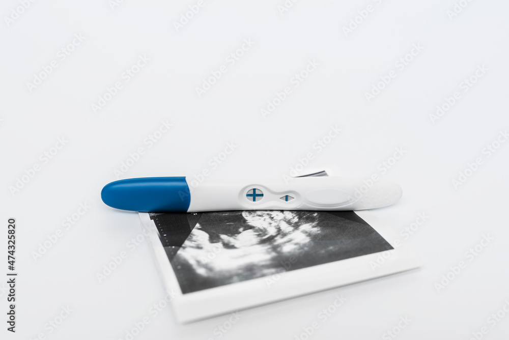 Positive pregnancy test on ultrasound photo. A positive pregnancy test ...