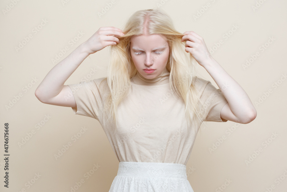 Cute albino girl on a beige background. Stock Photo | Adobe Stock