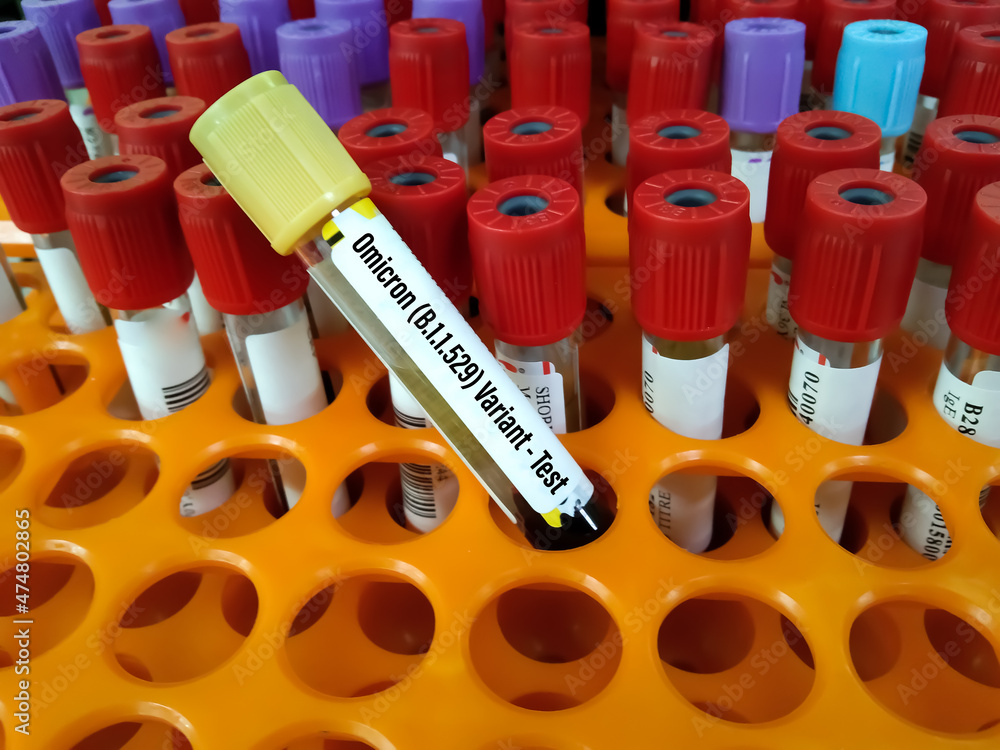 Blood positive sample tube for Sars-Cov-2, Covid-19 new variant Omicron ...
