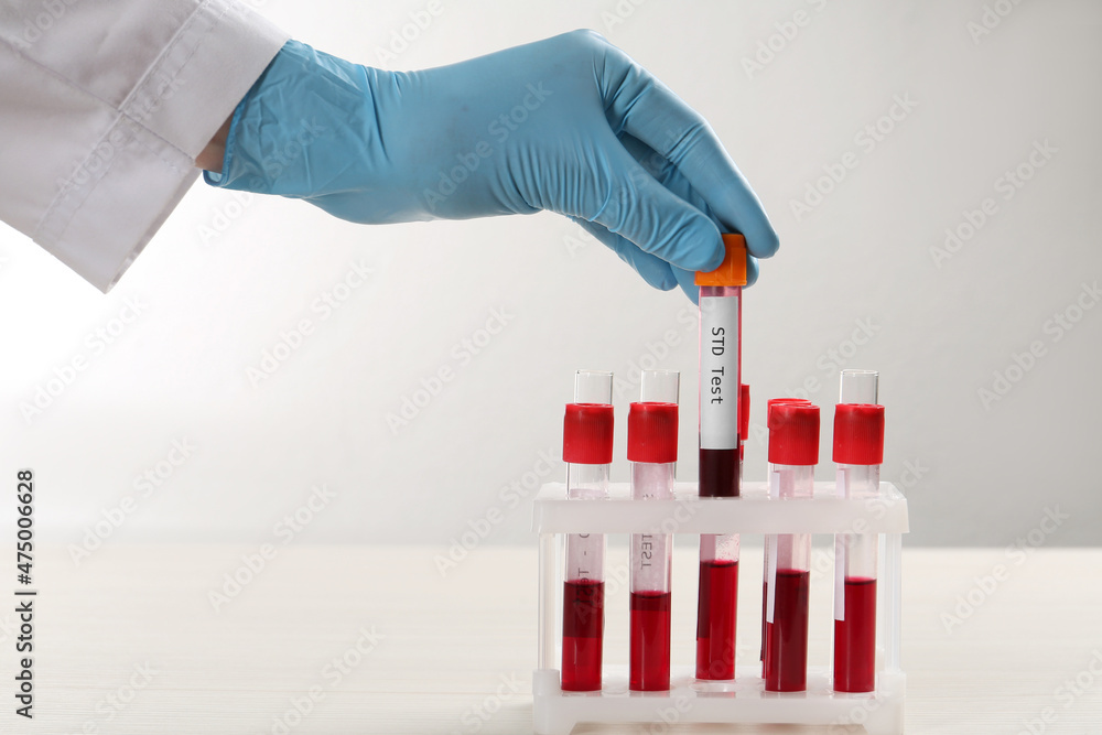 Scientist taking tube with blood sample and label STD Test from rack at ...