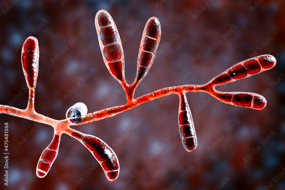 Microscopic fungi Epidermophyton floccosum, scientific illustration ...
