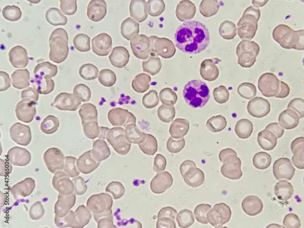 Blood smear microscopic show platelet, neutrophil, red blood cell and ...