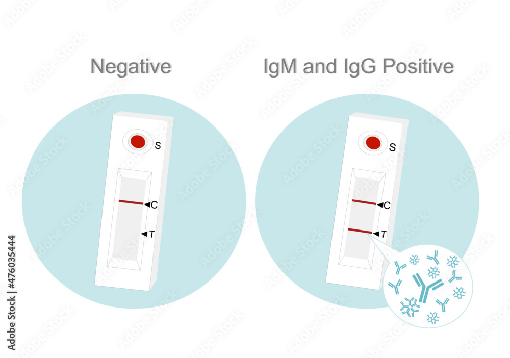 The interpretation of antibody (IgM and IgG) rapid test kit result that ...