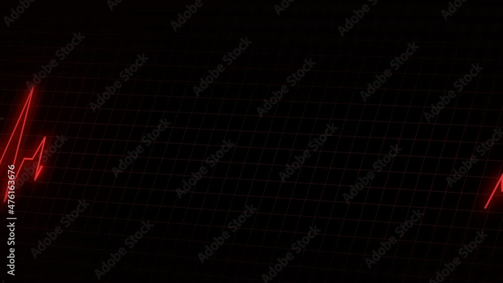 ECG Medical Heartbeat Pulsation Background Animation, Healthcare, and ...