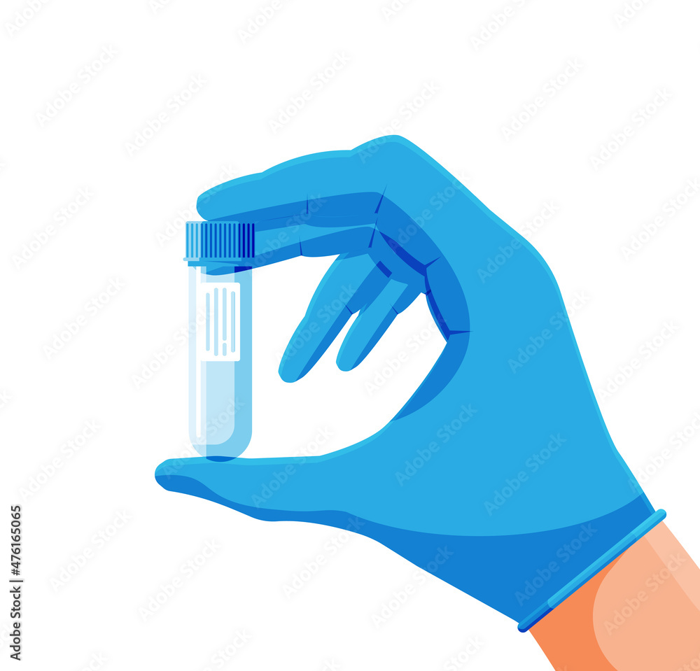 Test Tube with Cap in Hand. Medical Equipment. Specimen Cups for ...