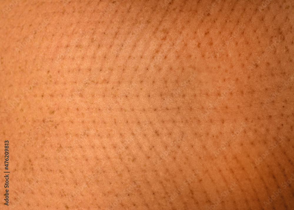 texture of human skin after massage with needles. Stock Photo | Adobe Stock