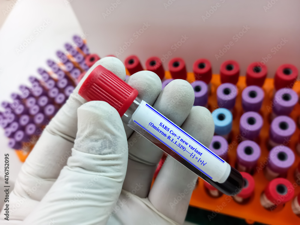Blood sample tube for Covid 19 omicron variant test. SARS Cov-2 omicron ...