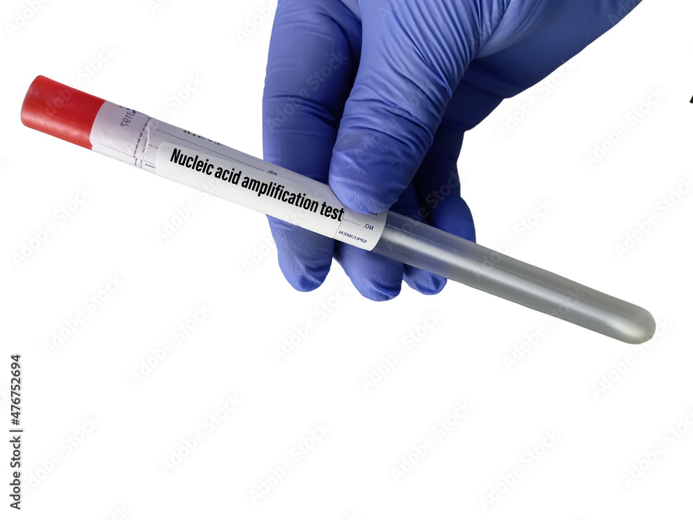 Nasal swab from patients for nucleic acids amplification test, RNA SARS ...