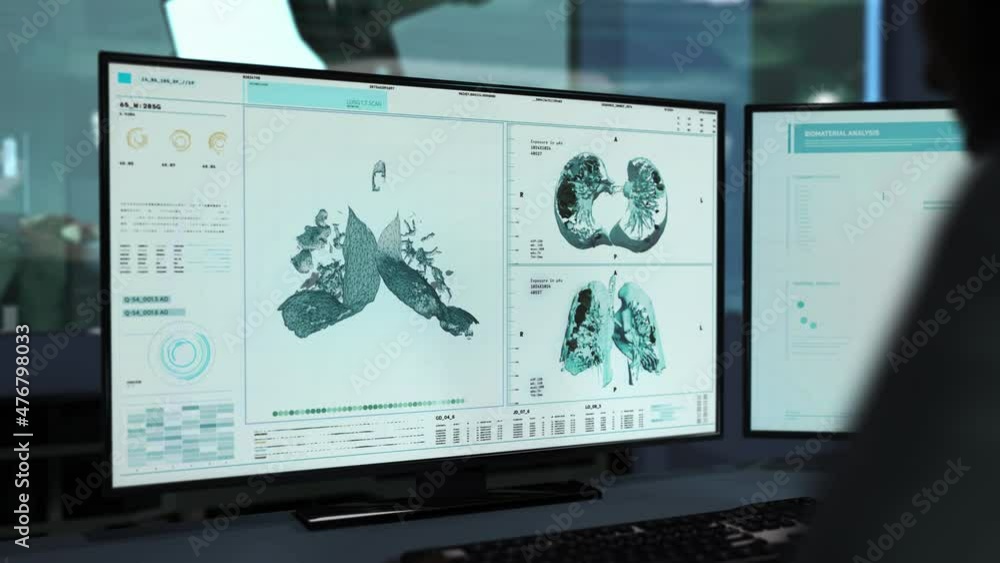 Patients Lung Mri Scanner Detects Cancer Disease. High Tech Medical ...