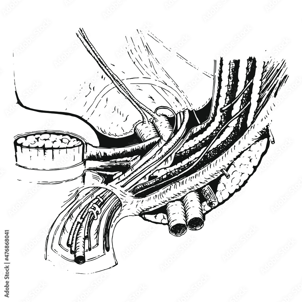 Anatomical drawing of the male inguinal region, spermatic funiculus ...