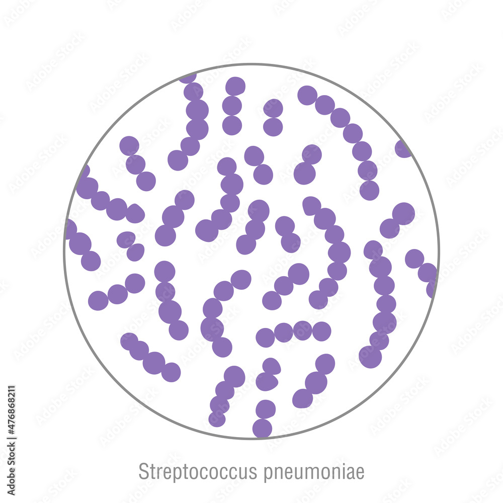 Streptococcus pneumoniae, pathogenic bacteria. Bacterial microorganism ...