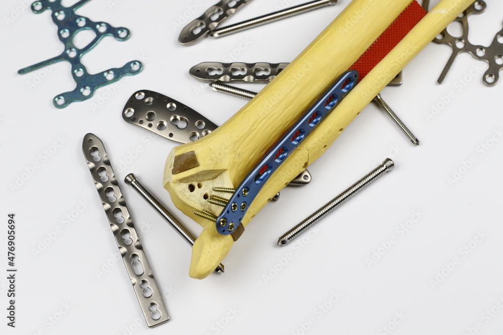 Surgical instruments for operation bone fractures Stock Photo | Adobe Stock