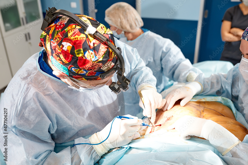 A surgeon with an assistant operates on the female breast, mammoplasty ...