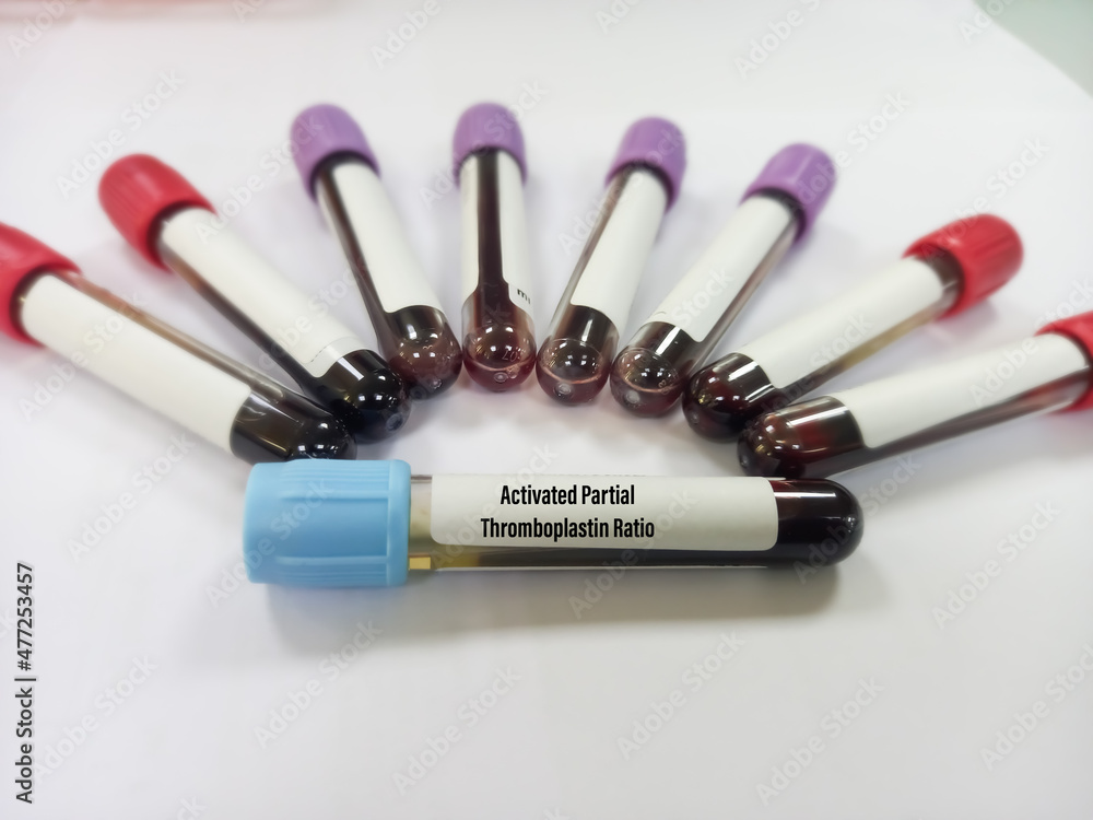 Blood sample tube for Activated Partial Thromboplastin Ratio (APTR ...