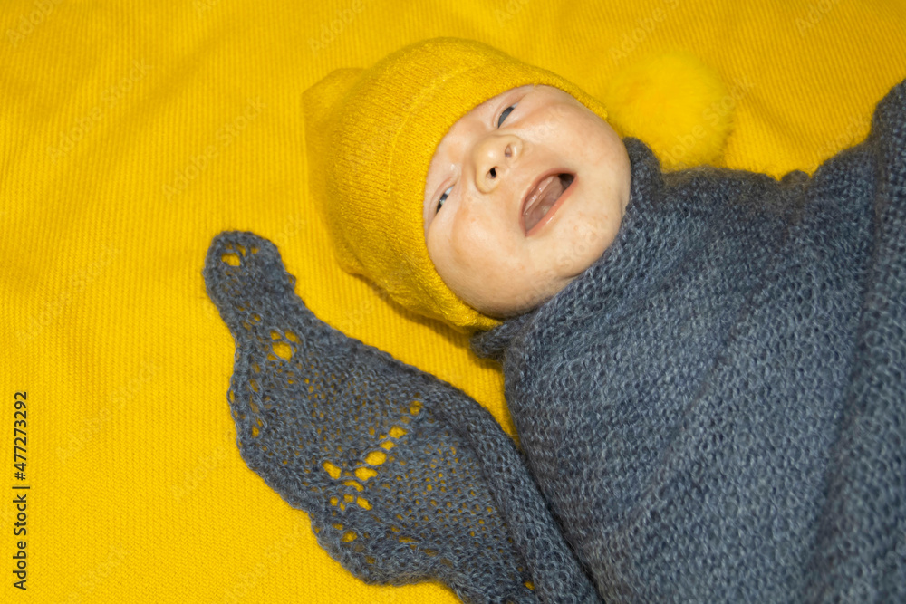 Newborn baby with acne and pimples on a yellow and gray background. A ...