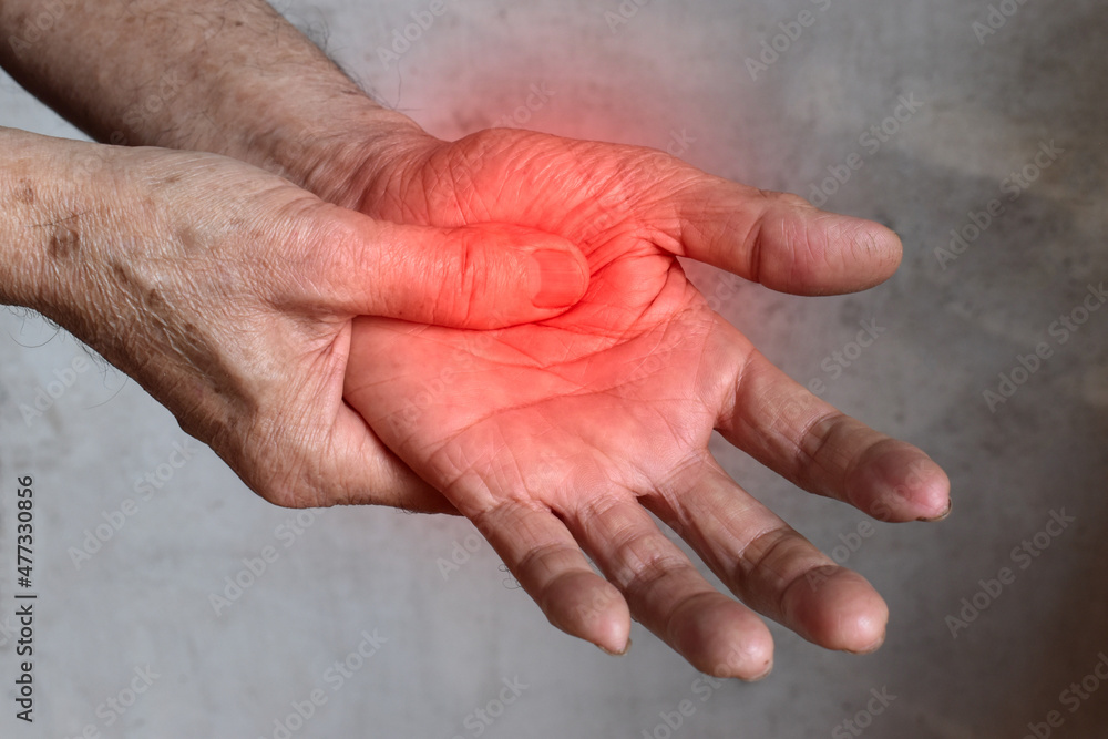 Painful palm of Asian man. Concept of compartment syndrome, cellulitis ...