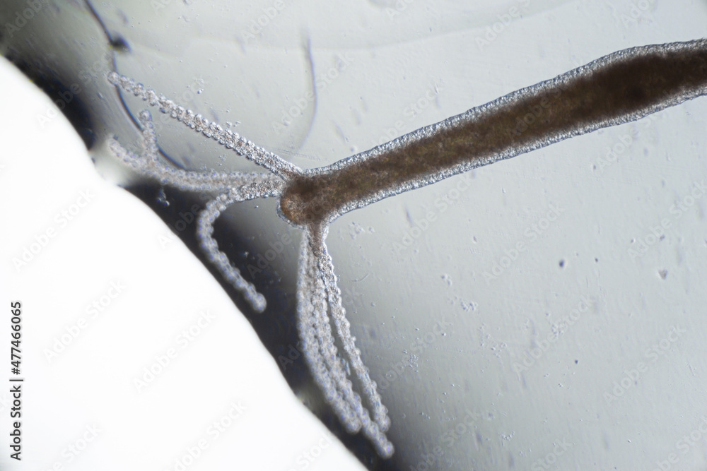 Hydra vulgaris under a light microscope, freshwater hydra taken from ...