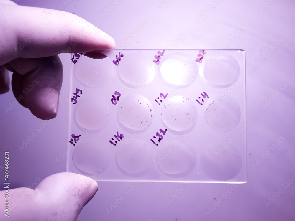 RPR, VDRL, Syphilis test glass slide agglutination method. showing ...