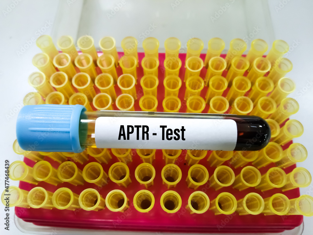 Foto de Blood sample tube for Activated Partial Thromboplastin Ratio ...