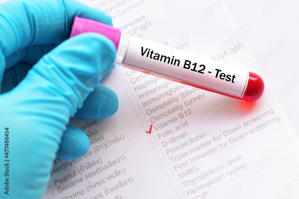 Blood sample tube with laboratory requisition form for vitamin B12 test ...