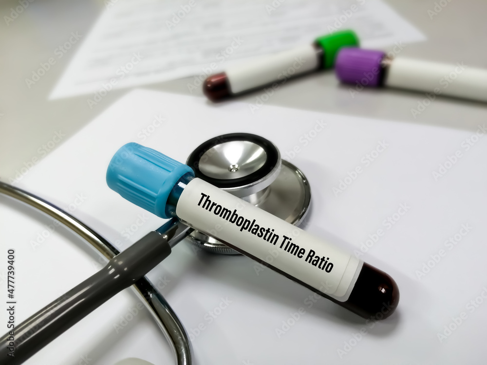 Blood sample tube for Thromboplastin Time Ratio test at medical ...